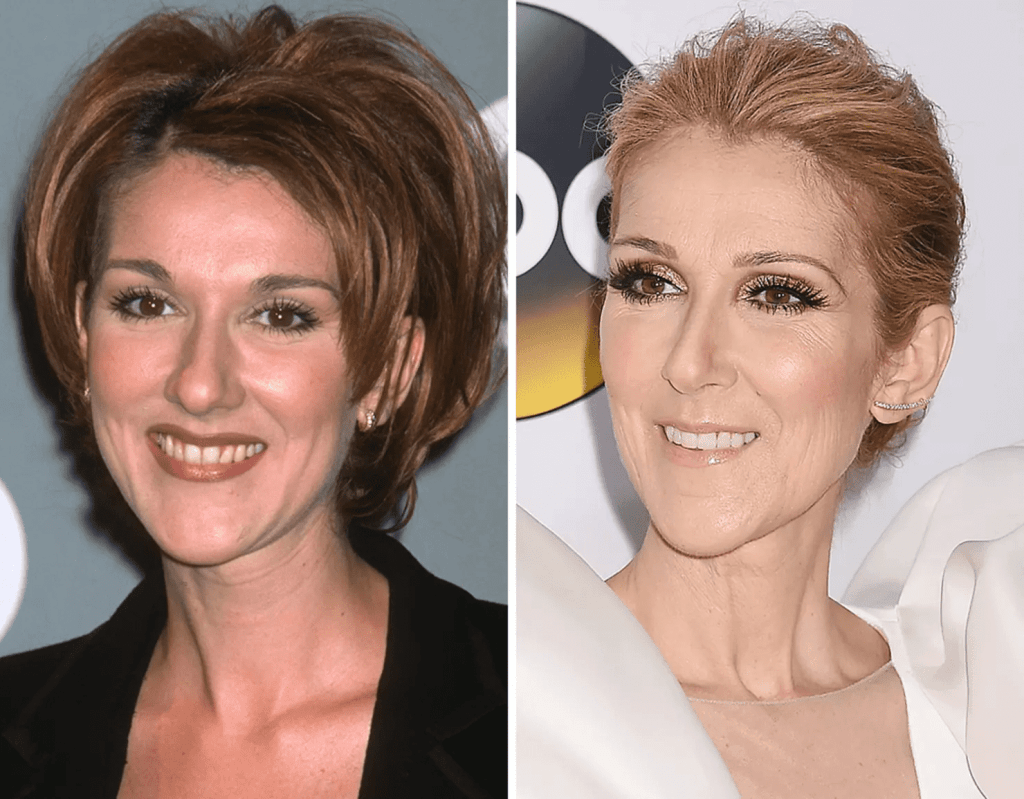 Hollywood Smile Design: Prices, Procedure in Turkey