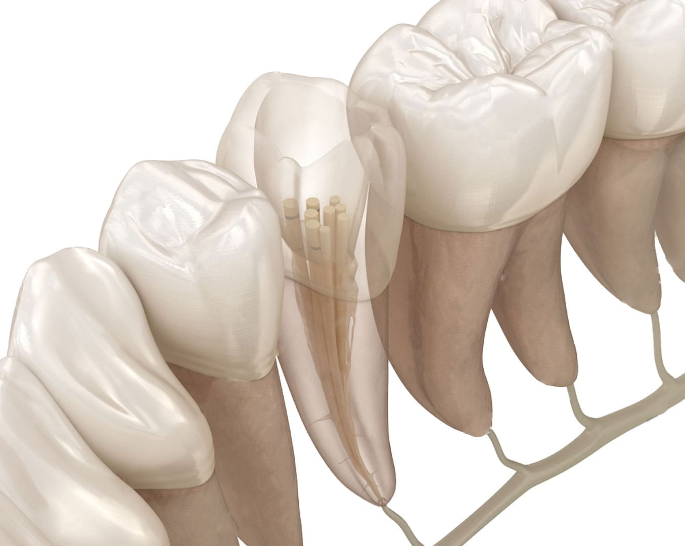 Rejeneratif Endodonti Tedavi - Ekiz Diş Kliniği